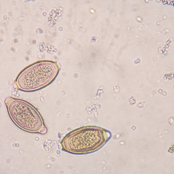 Trichomonas Parasite - Causes, Symptoms, Treatment & More!